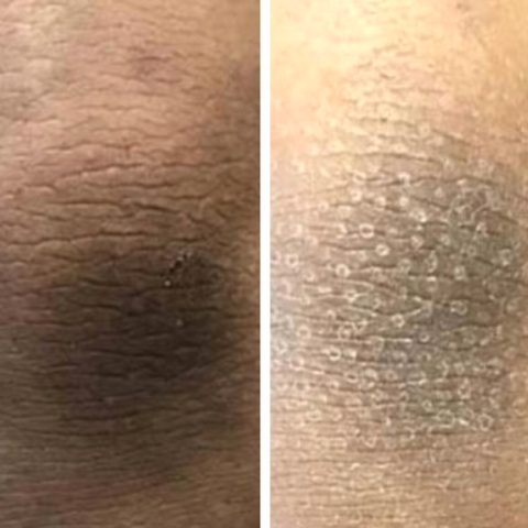 Intimate Whitening Services in Sydney | Salon Station – SALON STATION